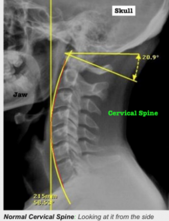 What Is a Normal Spine? | Spineology Chiropractic