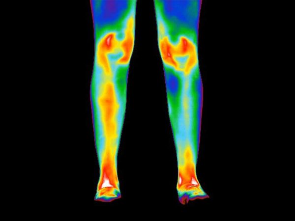 Uses for Thermography | Spineology Chiropractic